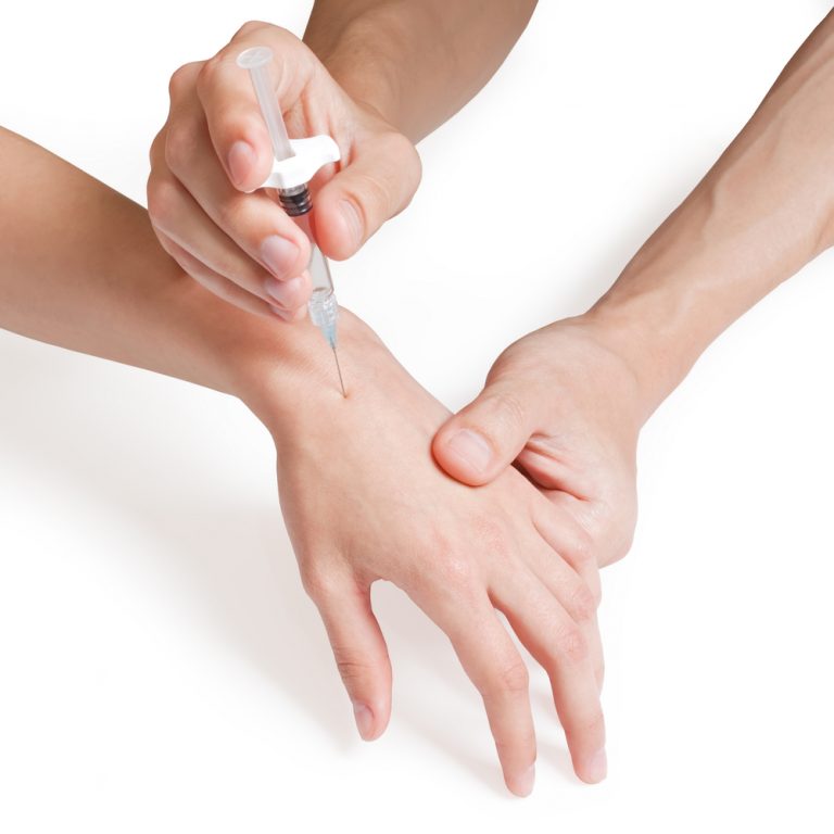 Corticosteroïd injectie in Schouder, Knie, Heup?