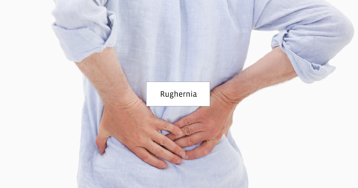 Rug Hernia: Oorzaak, Symptomen & Behandeling