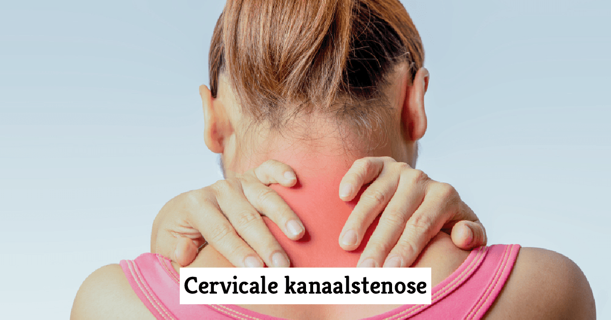 Cervicale kanaalstenose: symptomen en behandeling | Betekenis