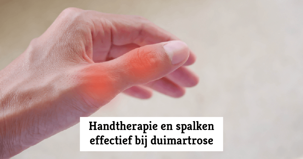 Handtherapie en spalken effectief bij duim-artrose | Tapen