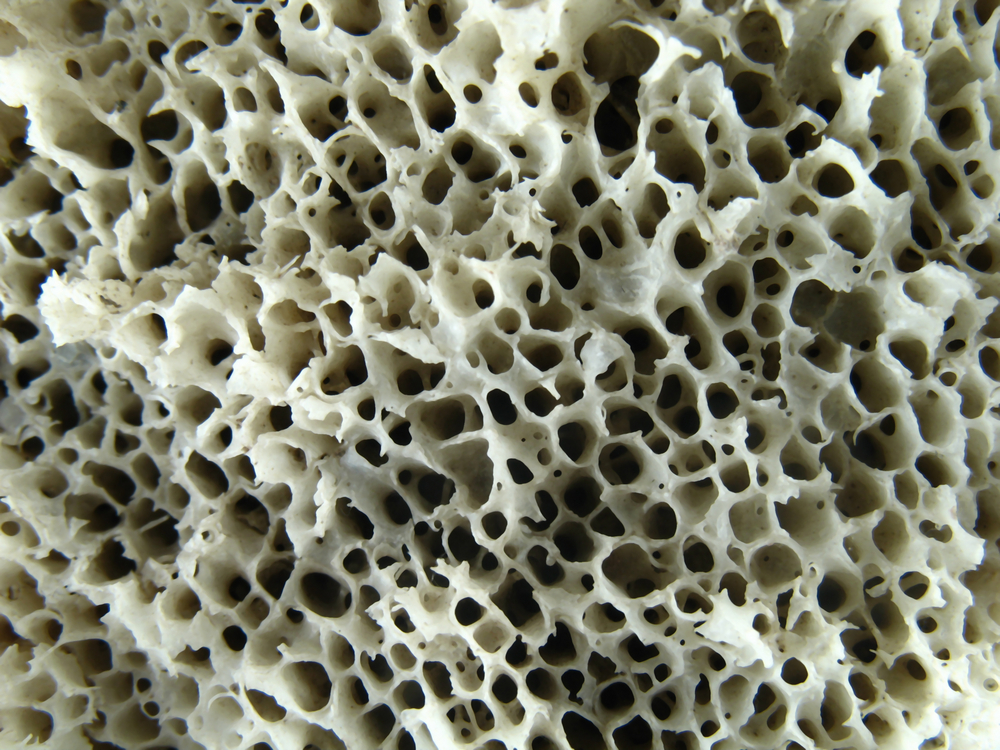 Osteopenie: zwakke botten die nog niet zo gemakkelijk breken