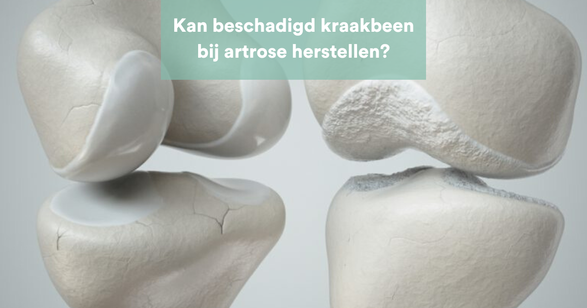 Kan beschadigd kraakbeen herstellen? | Voet, knie, heup, schouder